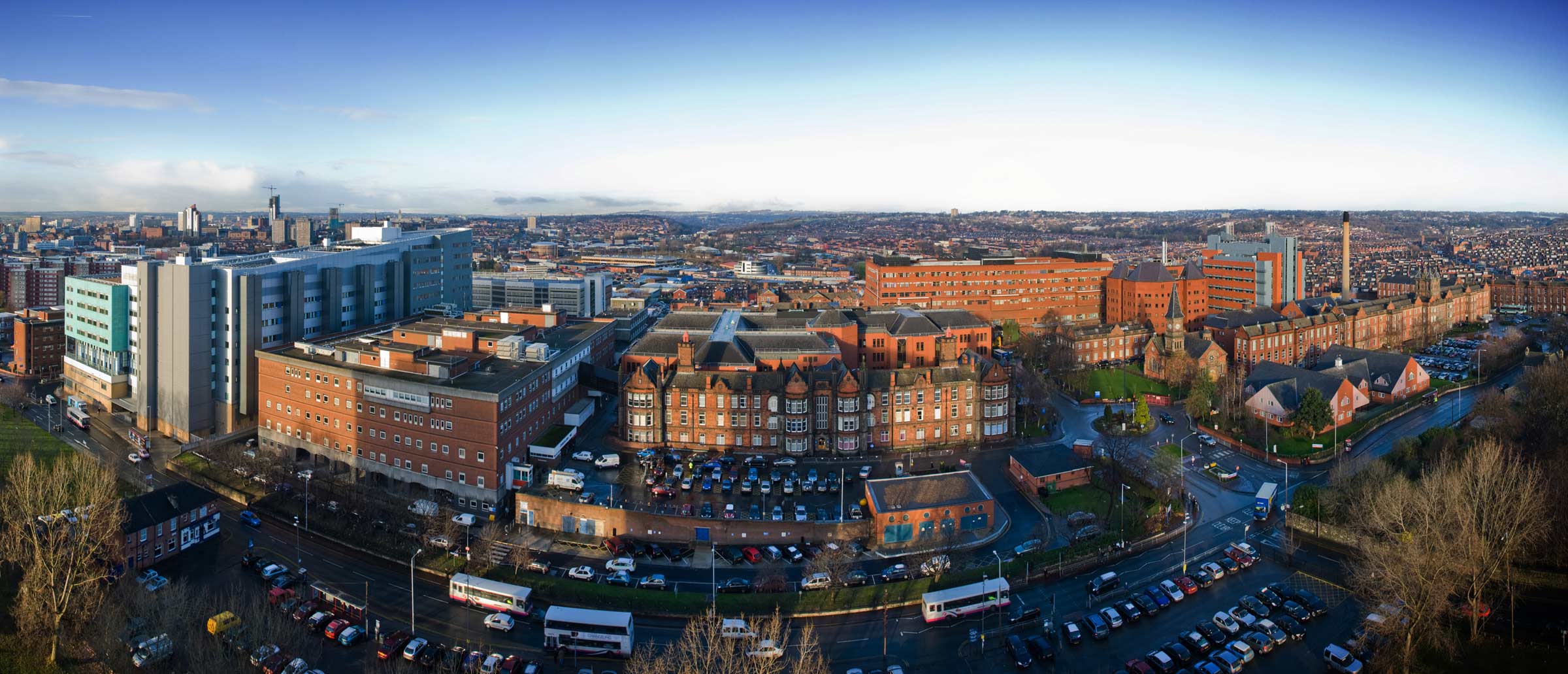 Fibroids Nice Cks PDF) Study Protocol For The Implementation Of