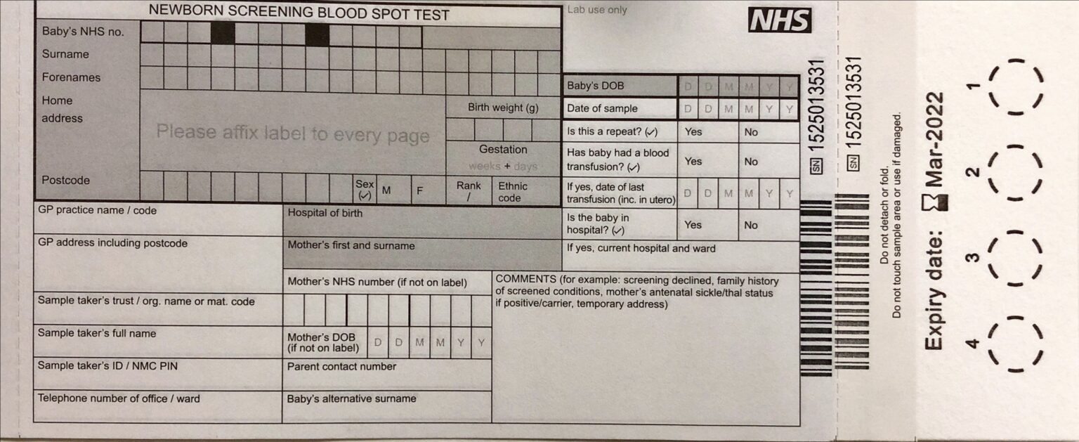 CMV (congenital testing using newborn bloodspots) - Leeds Teaching ...