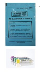 TB Quantiferon -IFN-gamma test - Leeds Teaching Hospitals NHS Trust