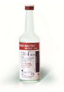 AAFB Blood culture - Leeds Teaching Hospitals NHS Trust