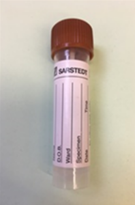 Faecal elastase - Leeds Teaching Hospitals NHS Trust