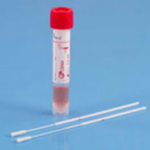 Viral Conjunctivitis: Eye Swabs for diagnosis by PCR - Leeds Teaching ...