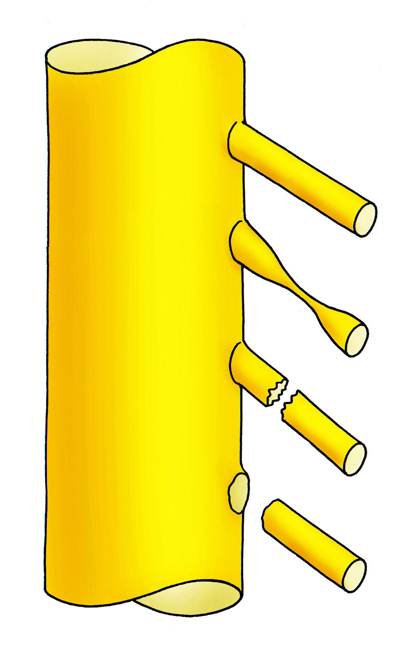 Brachial plexus condition and treatment - Leeds Teaching Hospitals NHS ...