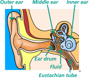 What is glue ear? - Leeds Teaching Hospitals NHS Trust