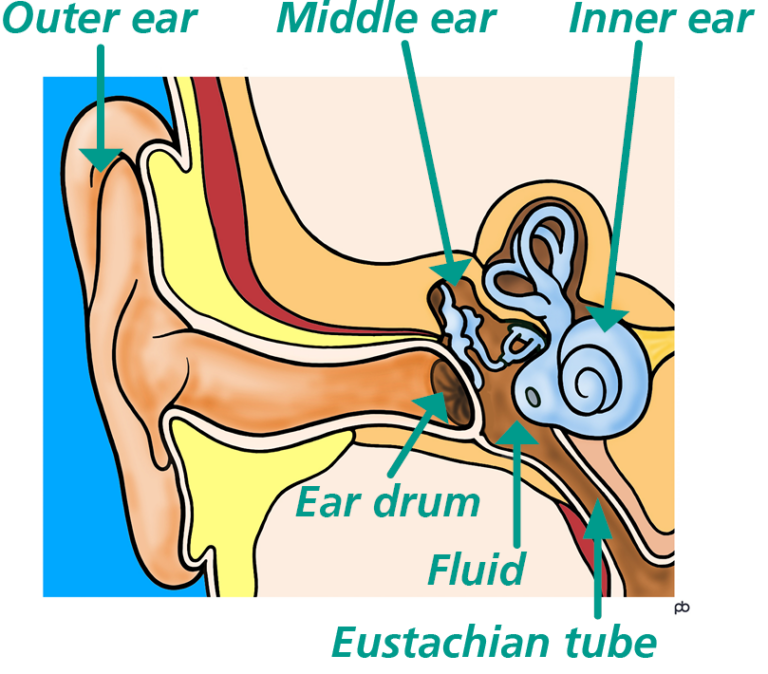 What is glue ear? - Leeds Teaching Hospitals NHS Trust