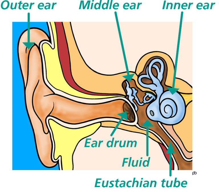 What Is Glue Ear Leeds Teaching Hospitals NHS Trust What Is Glue Ear Leeds Teaching Hospitals NHS Trust
