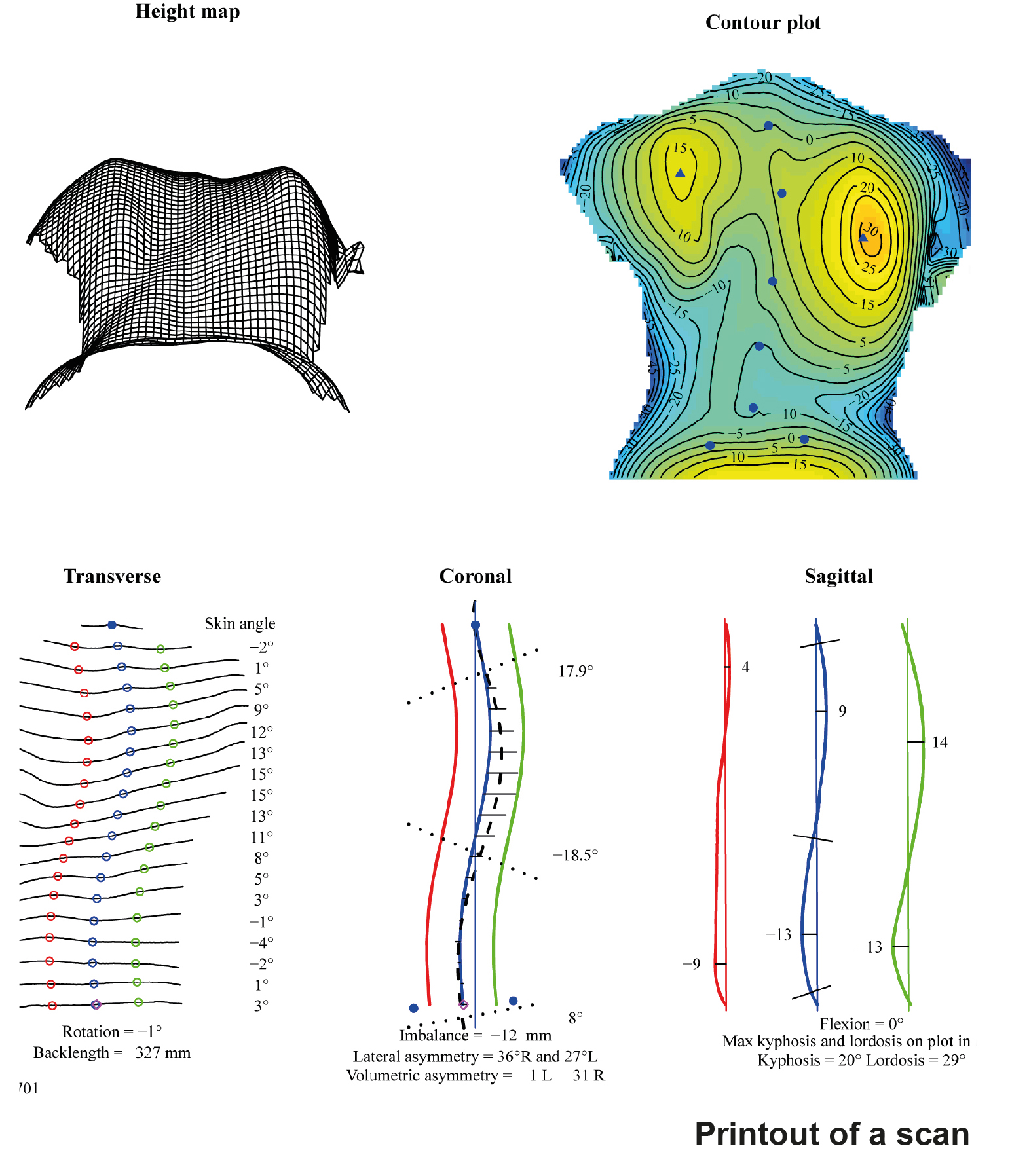 Surface Topography - Leeds Teaching Hospitals NHS Trust