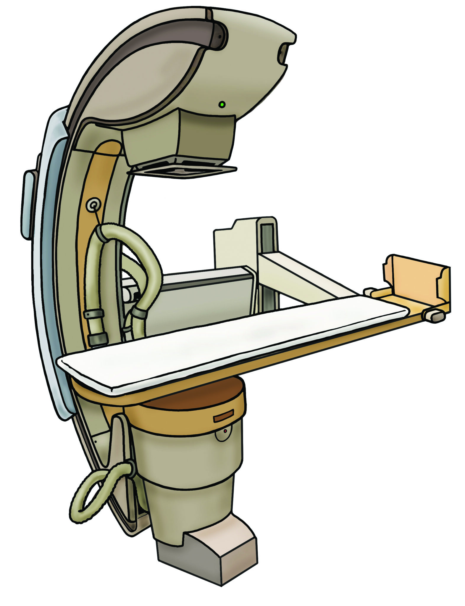 Hysterosalpingography (HSG) - Leeds Teaching Hospitals NHS Trust