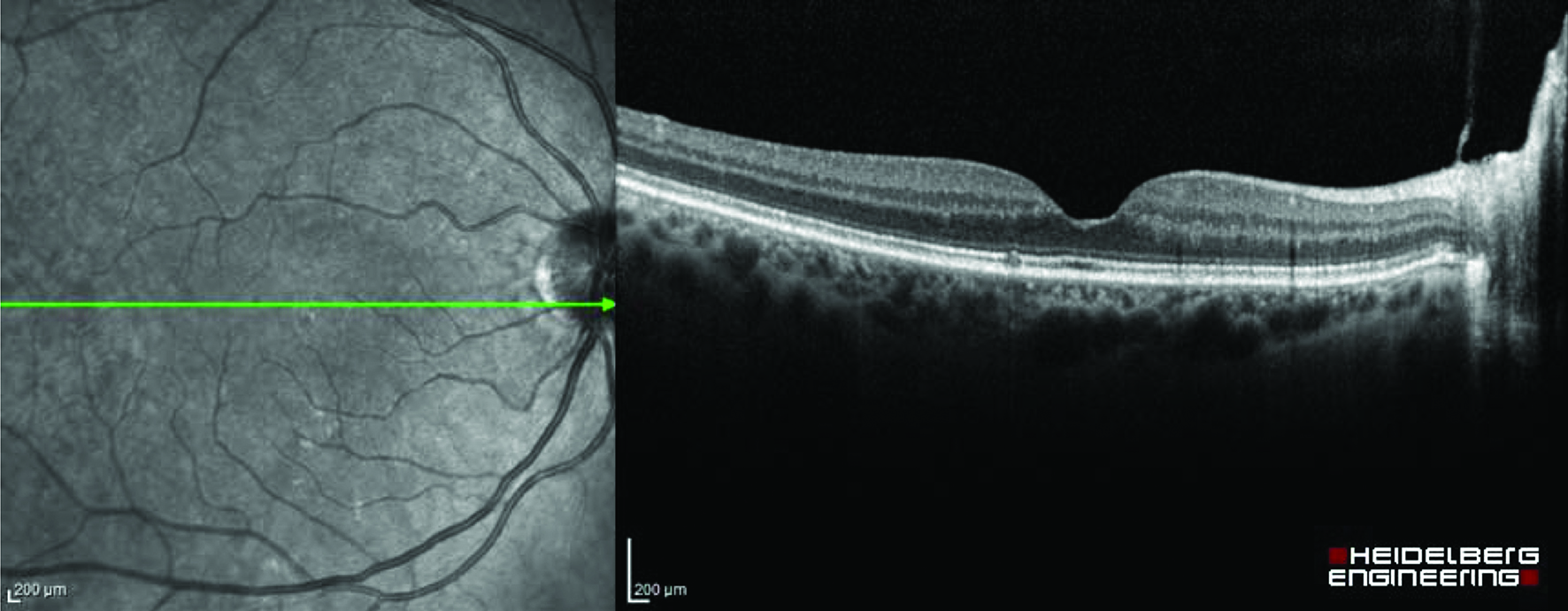 Photographing your eye: Ophthalmic Imaging - Leeds Teaching Hospitals NHS Trust