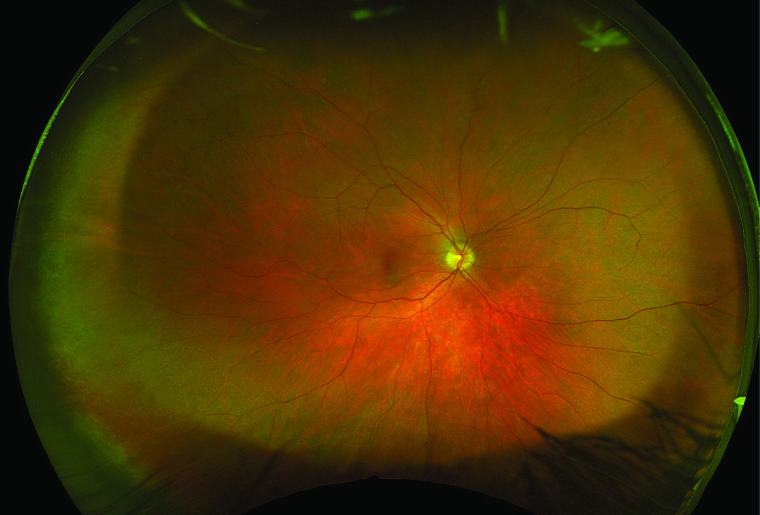 Photographing your eye: Ophthalmic Imaging - Leeds Teaching Hospitals ...