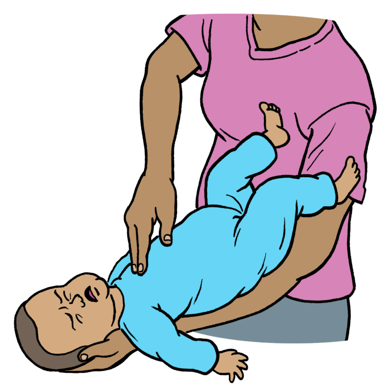 Baby Basic Life Support - Leeds Teaching Hospitals NHS Trust