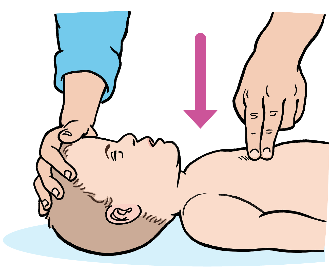 Baby Basic Life Support - Leeds Teaching Hospitals NHS Trust