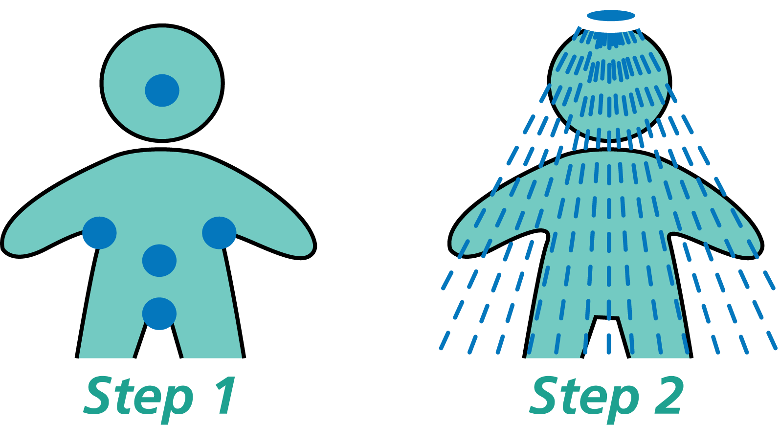 MRSA screening and decolonisation - Leeds Teaching Hospitals NHS Trust