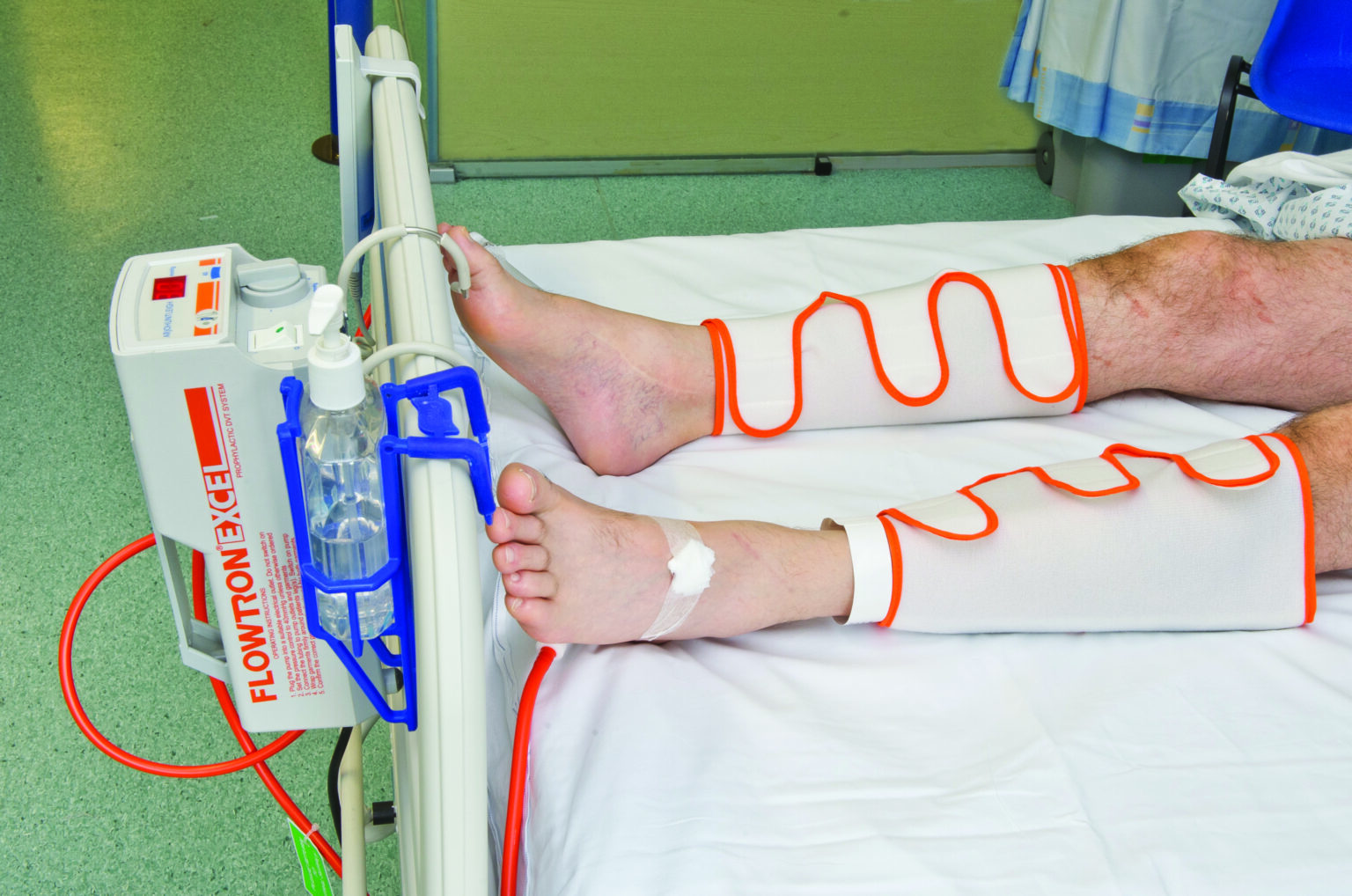 Preventing blood clots (Deep vein thrombosis and pulmonary embolism ...