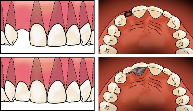 Bridges - Leeds Teaching Hospitals NHS Trust