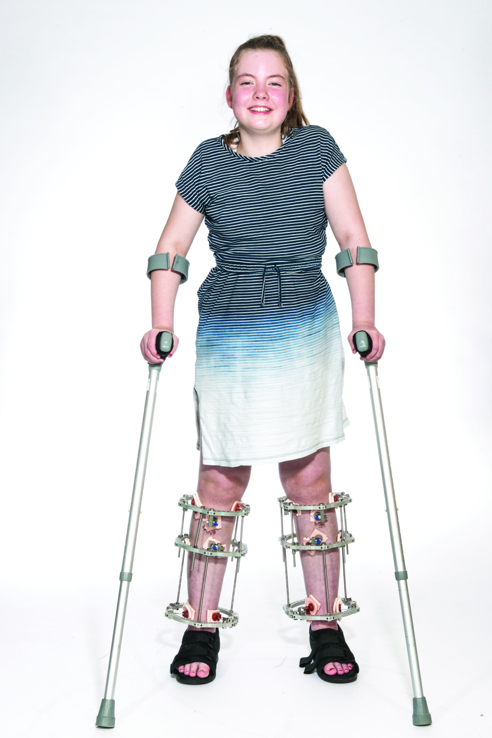 Circular Frame Treatment and Care for Children and Young People - Leeds ...