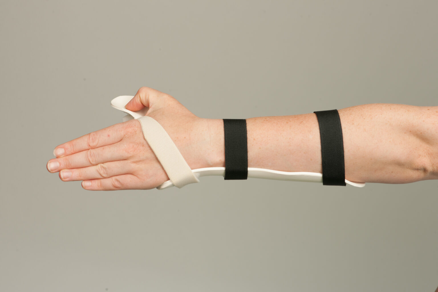 Extensor Tendon Repair (thumb), a guide to your therapy - Leeds ...