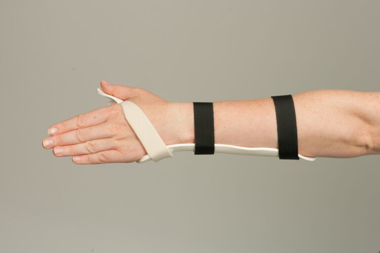 Extensor Tendon Repair (thumb), a guide to your therapy - Leeds ...