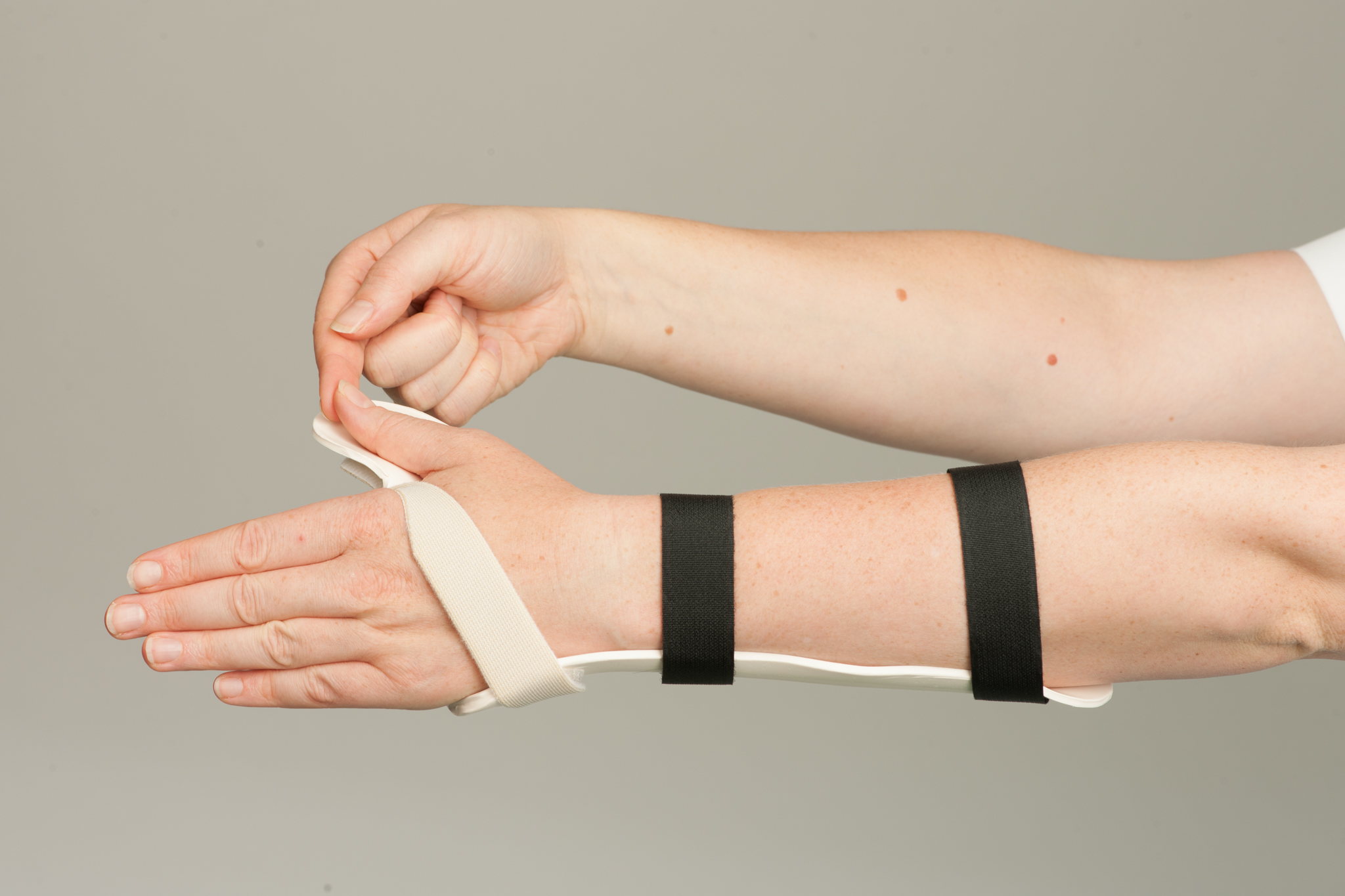 Extensor Tendon Repair (thumb), a guide to your therapy - Leeds Teaching Hospitals NHS Trust