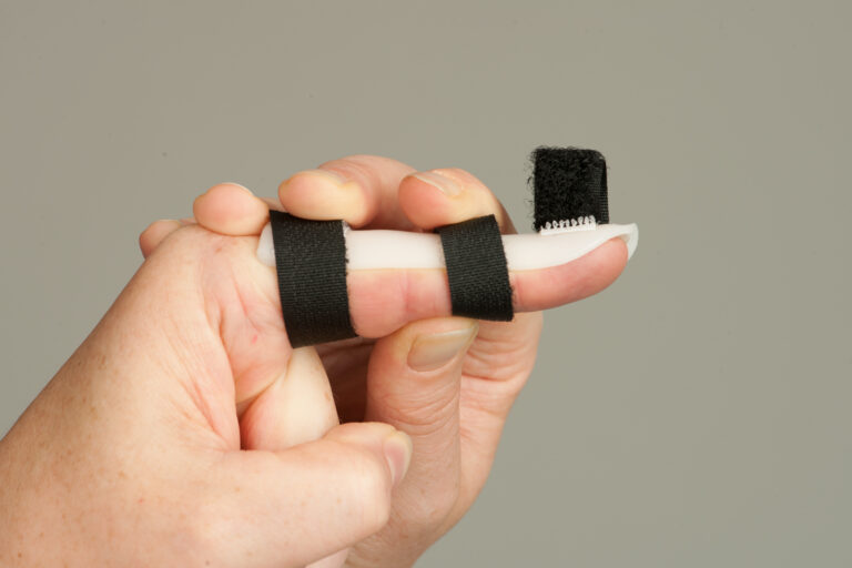 Extensor Tendon Repair - Central Slip, a guide to your therapy - Leeds ...