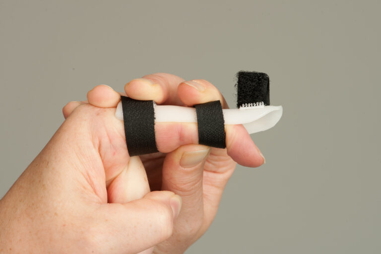 Extensor Tendon Repair - Central Slip, a guide to your therapy - Leeds ...