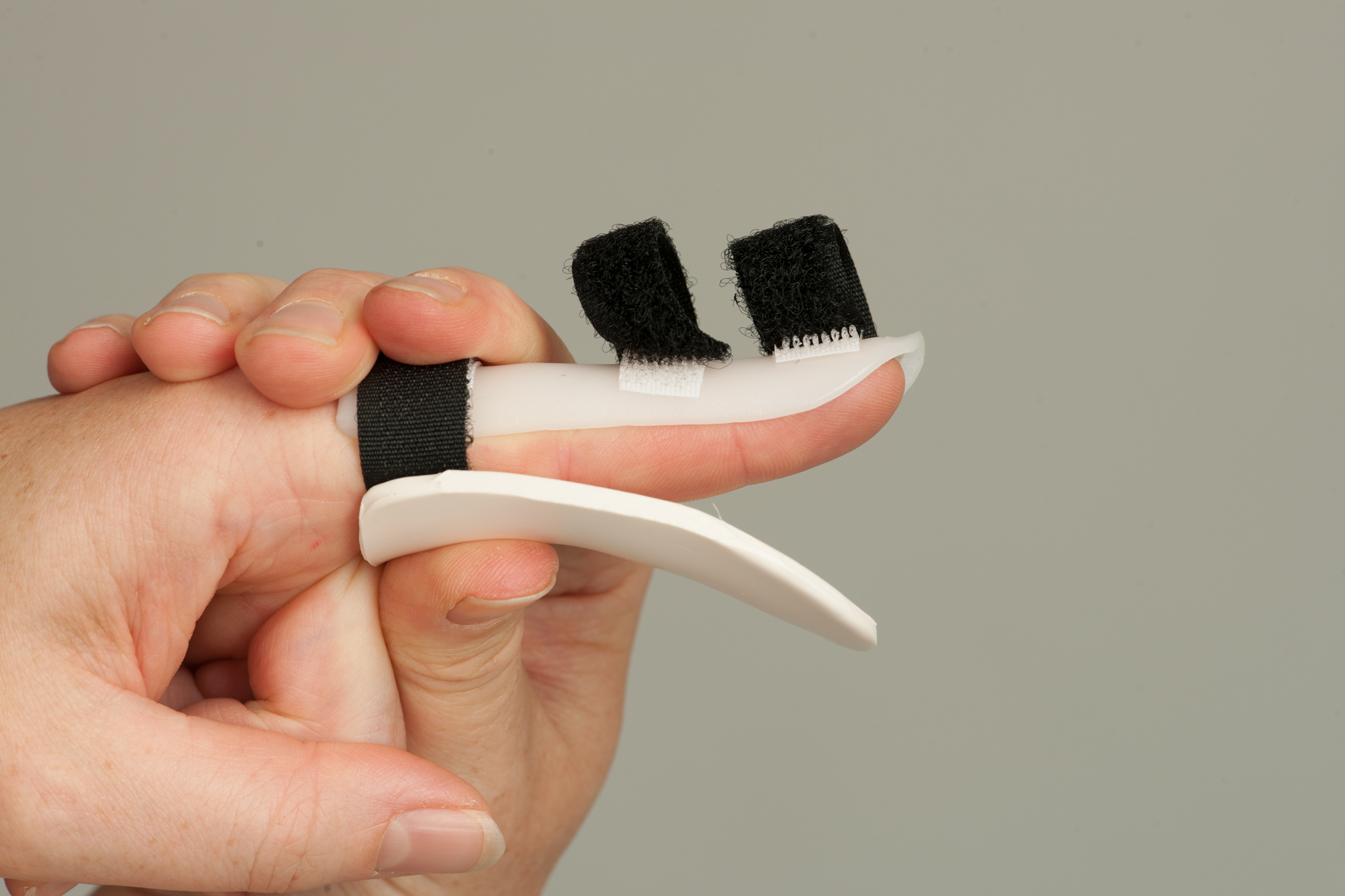 Extensor Tendon Repair - Central Slip, a guide to your therapy - Leeds ...