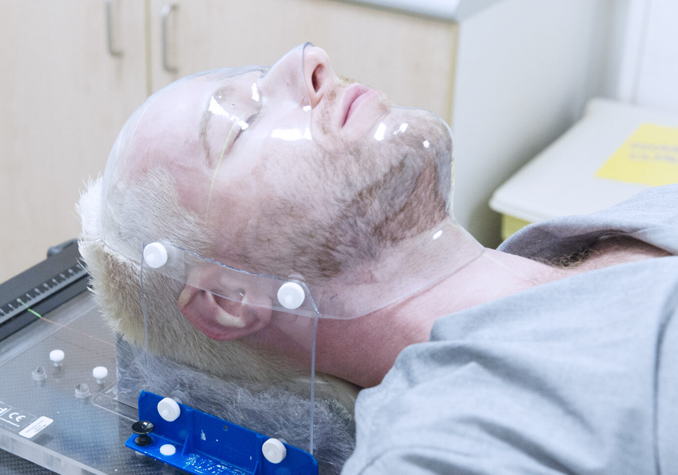 Radiotherapy for Skin Lesions - Leeds Teaching Hospitals NHS Trust