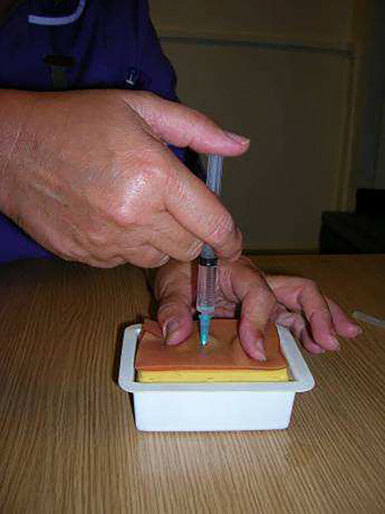 Emergency Hydrocortisone Injection - Leeds Teaching Hospitals NHS Trust