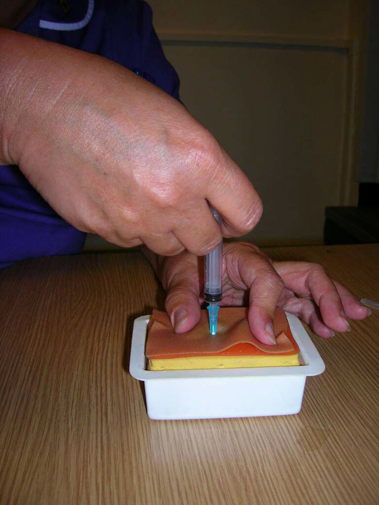 Emergency Hydrocortisone Injection - Leeds Teaching Hospitals NHS Trust
