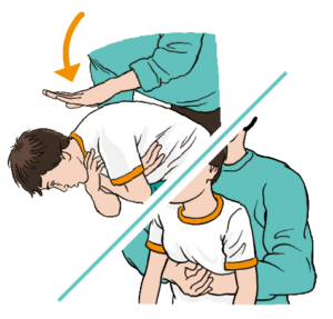 Child Basic Life Support - Leeds Teaching Hospitals NHS Trust