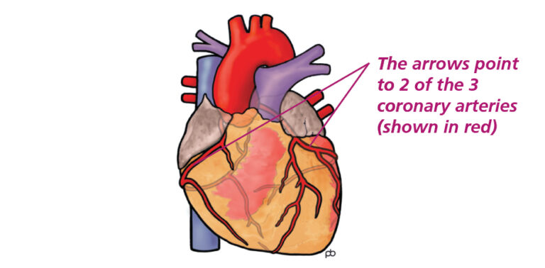 Understanding coronary angiography and coronary intervention - Leeds ...