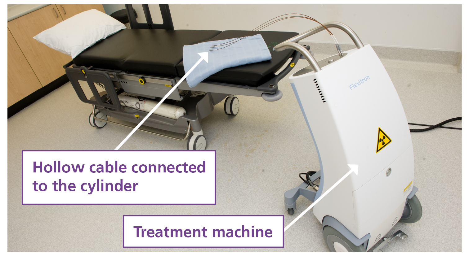 Internal radiotherapy to the cervix - Leeds Teaching Hospitals NHS Trust