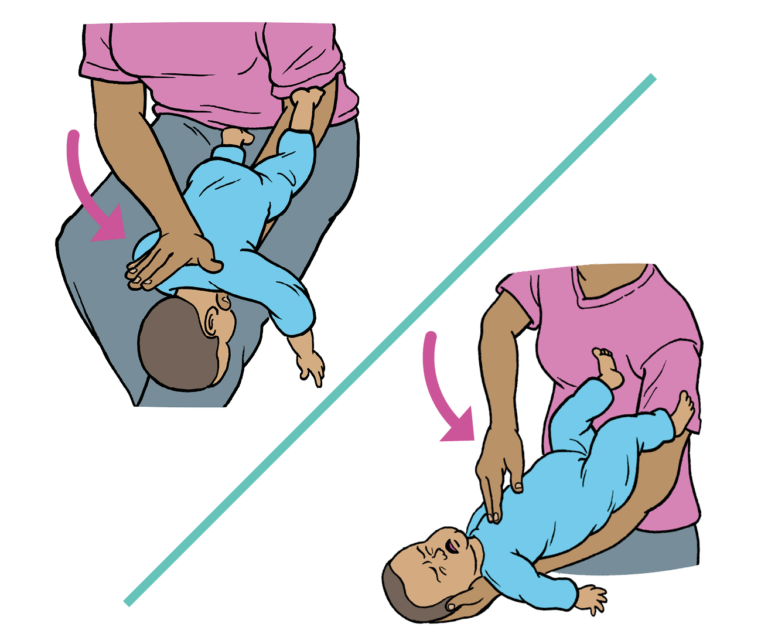 Baby Basic Life Support - Leeds Teaching Hospitals NHS Trust