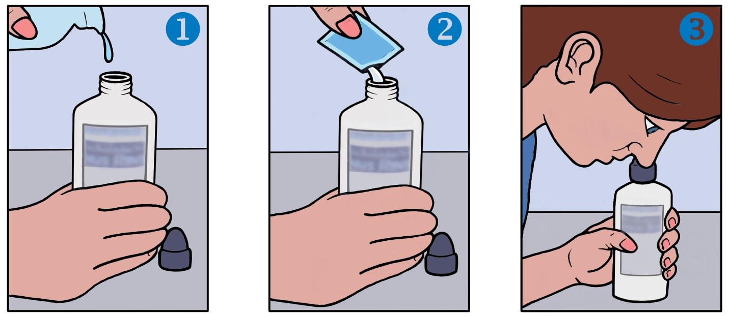 Budesonide application with Sinurinse - Leeds Teaching Hospitals NHS Trust