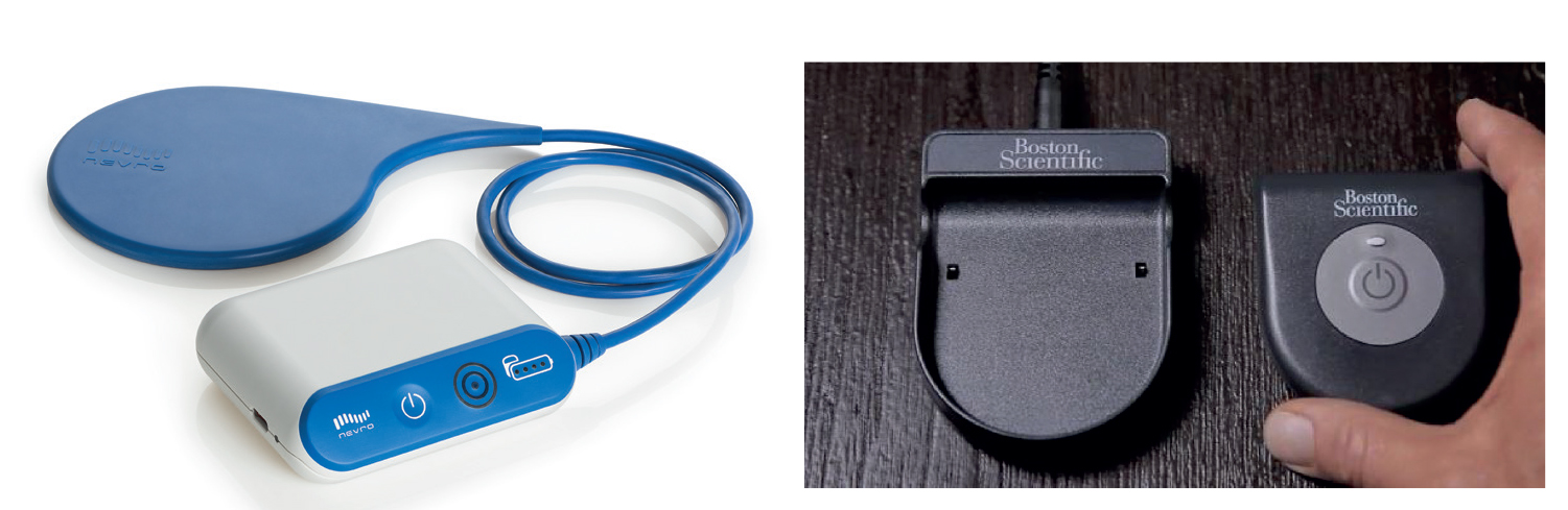 Spinal Cord Stimulation (SCS) - Leeds Teaching Hospitals NHS Trust