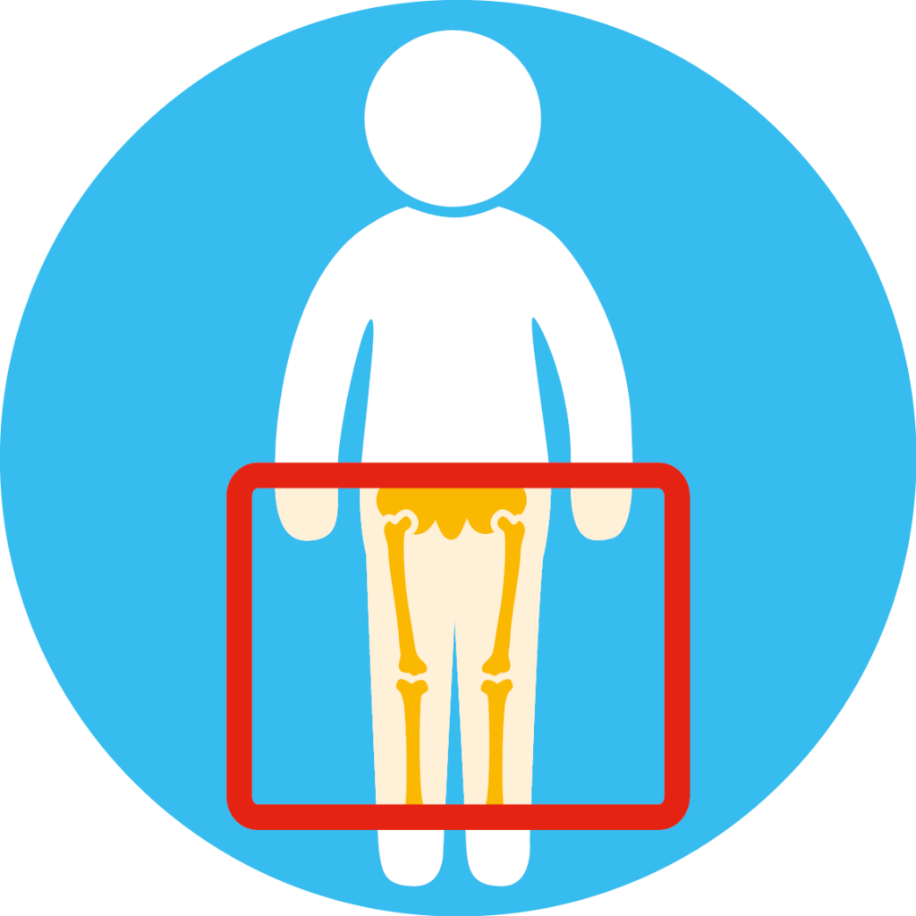 Having an X-ray - Leeds Teaching Hospitals NHS Trust