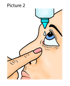 Eye drop instructions - Leeds Teaching Hospitals NHS Trust
