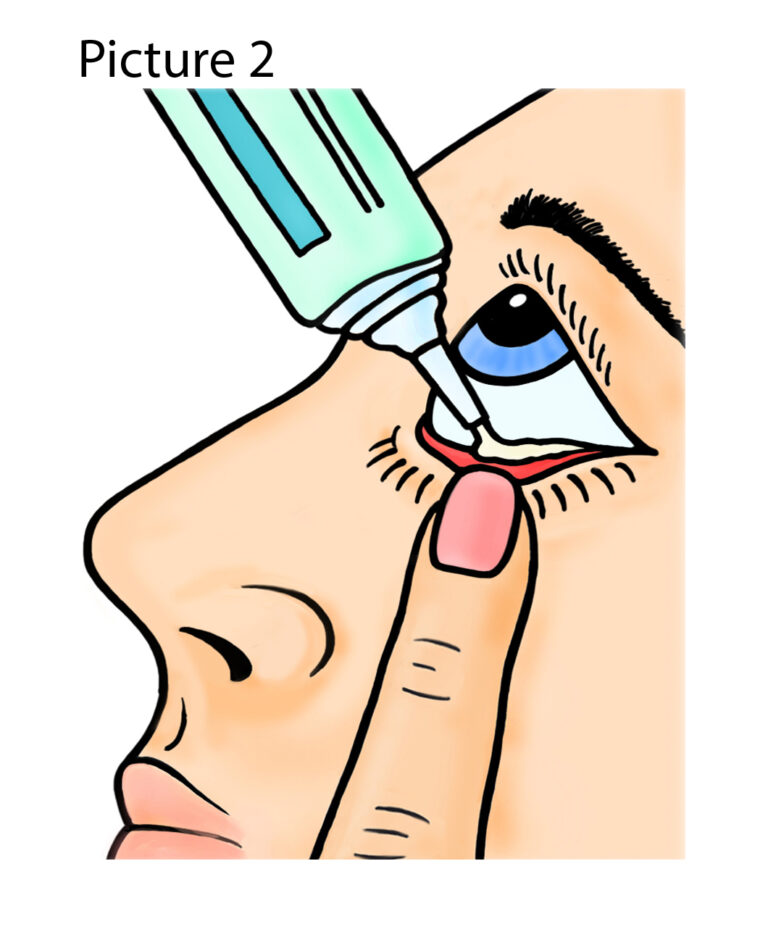 Eye ointment instructions - Leeds Teaching Hospitals NHS Trust