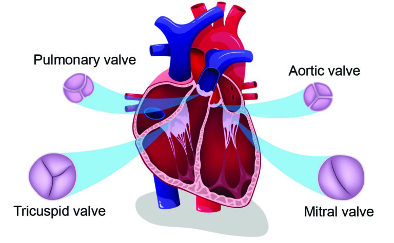 Aortic Regurgitation - Leeds Teaching Hospitals NHS Trust