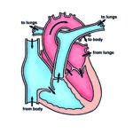 The Atrial Switch (Mustard or Senning) procedure for Transposition of ...
