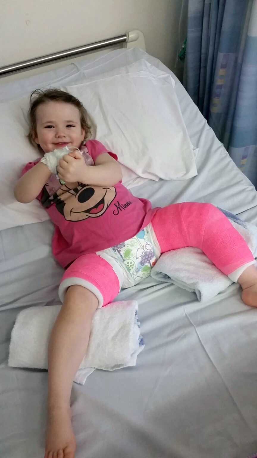Developmental Dysplasia of the Hip - Leeds Teaching Hospitals NHS Trust