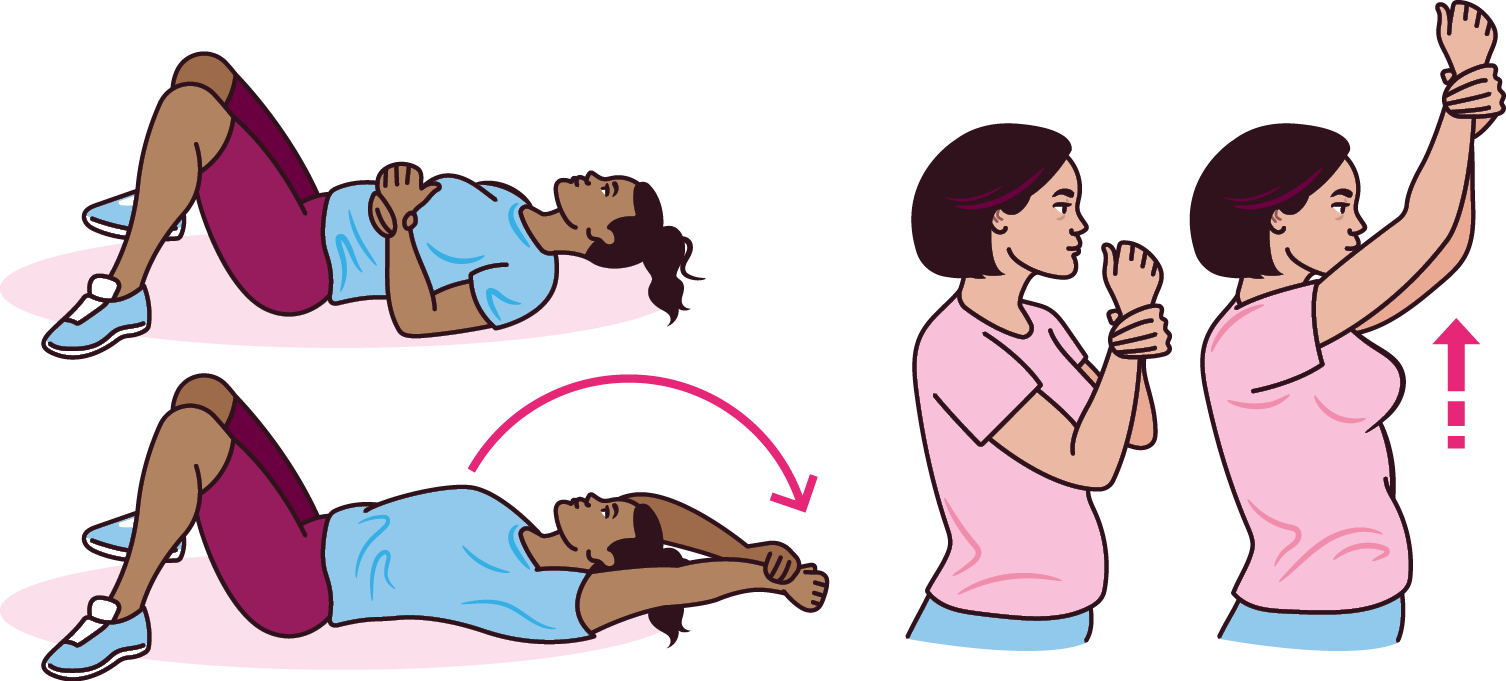 Physiotherapy exercises for breast pain with chest wall musculoskeletal ...