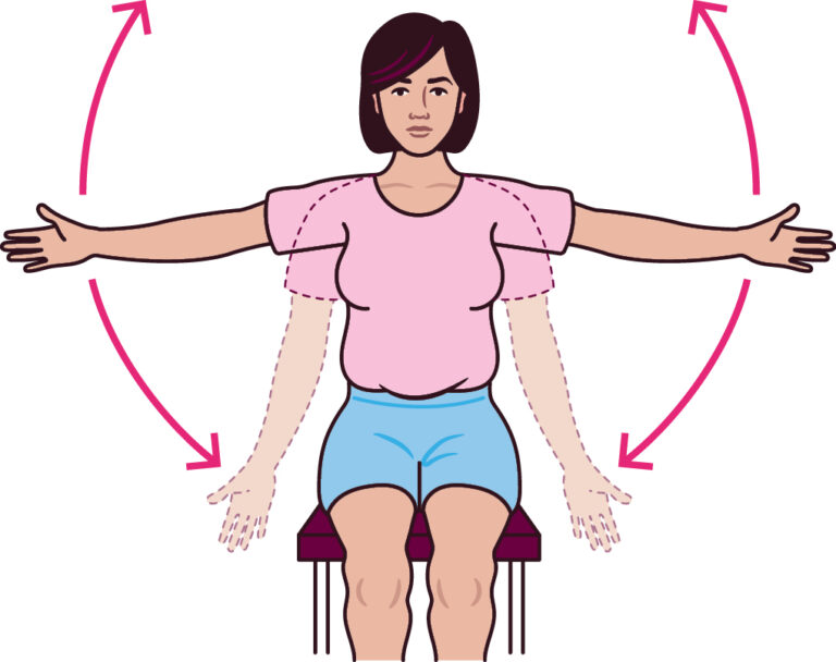 Physiotherapy exercises for breast pain with chest wall musculoskeletal ...