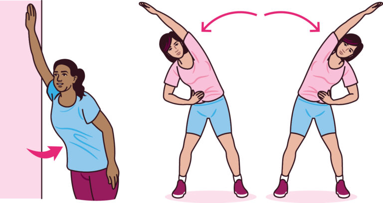 Physiotherapy exercises for breast pain with chest wall musculoskeletal ...