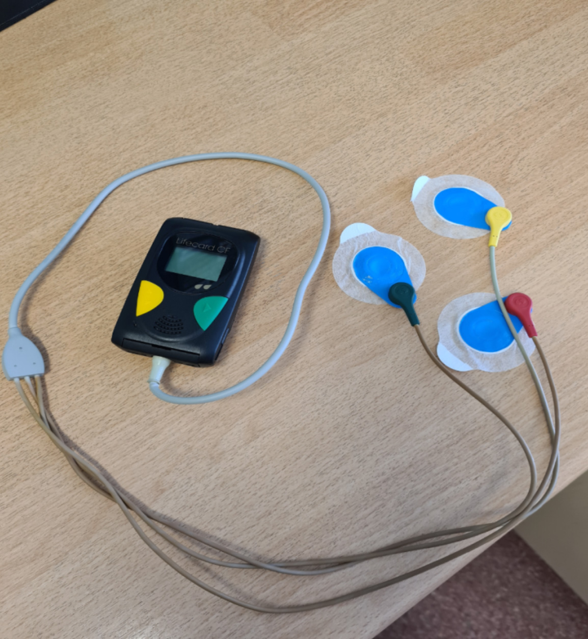Ambulatory ECG Monitoring - Leeds Teaching Hospitals NHS Trust