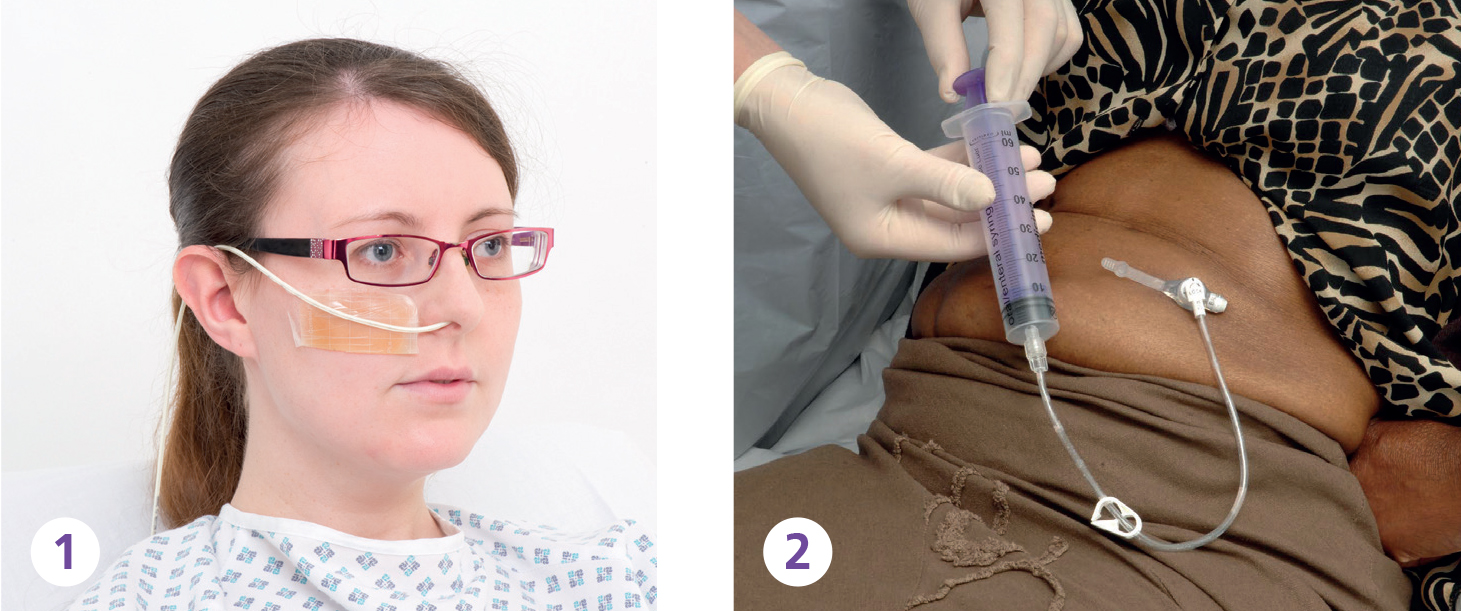 Radiotherapy to the head and neck - Leeds Teaching Hospitals NHS Trust