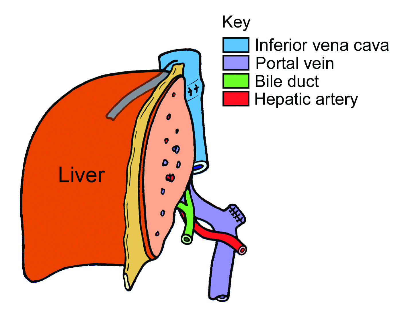 Liver Transplantation Book 1 - Leeds Teaching Hospitals NHS Trust