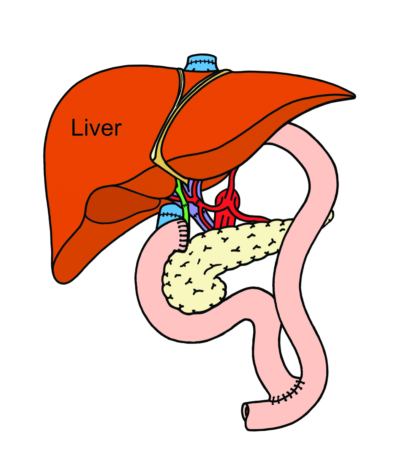 Liver Transplantation Book 1 - Leeds Teaching Hospitals NHS Trust