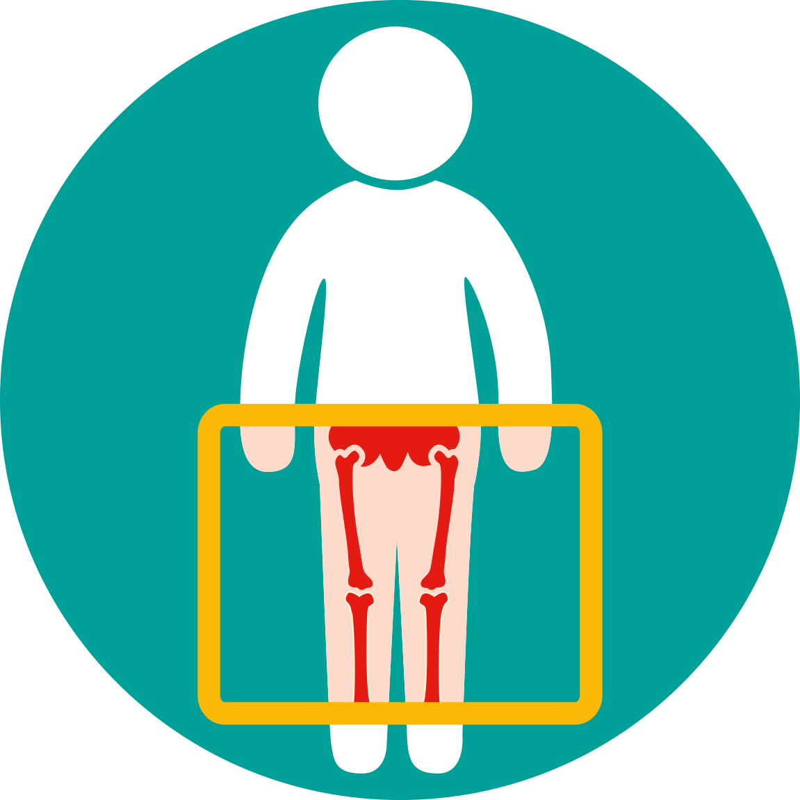 Your Child’s Bone Density (DXA) - Leeds Teaching Hospitals NHS Trust