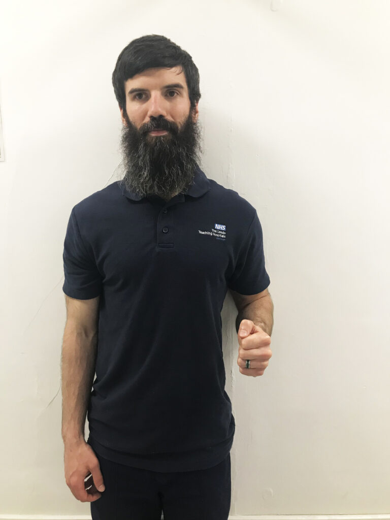 Anterior shoulder dislocation without bony injury - Leeds Teaching ...